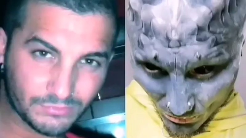 Totaal verbouwde 'Zwarte Alien' klaagt: ik ben gewoon normaal | Panorama